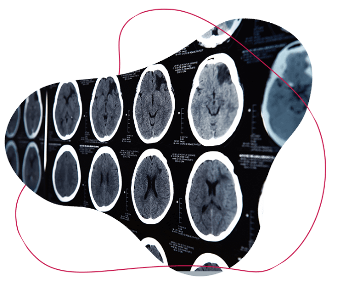 Graylight Imaging – Medical Imaging Software