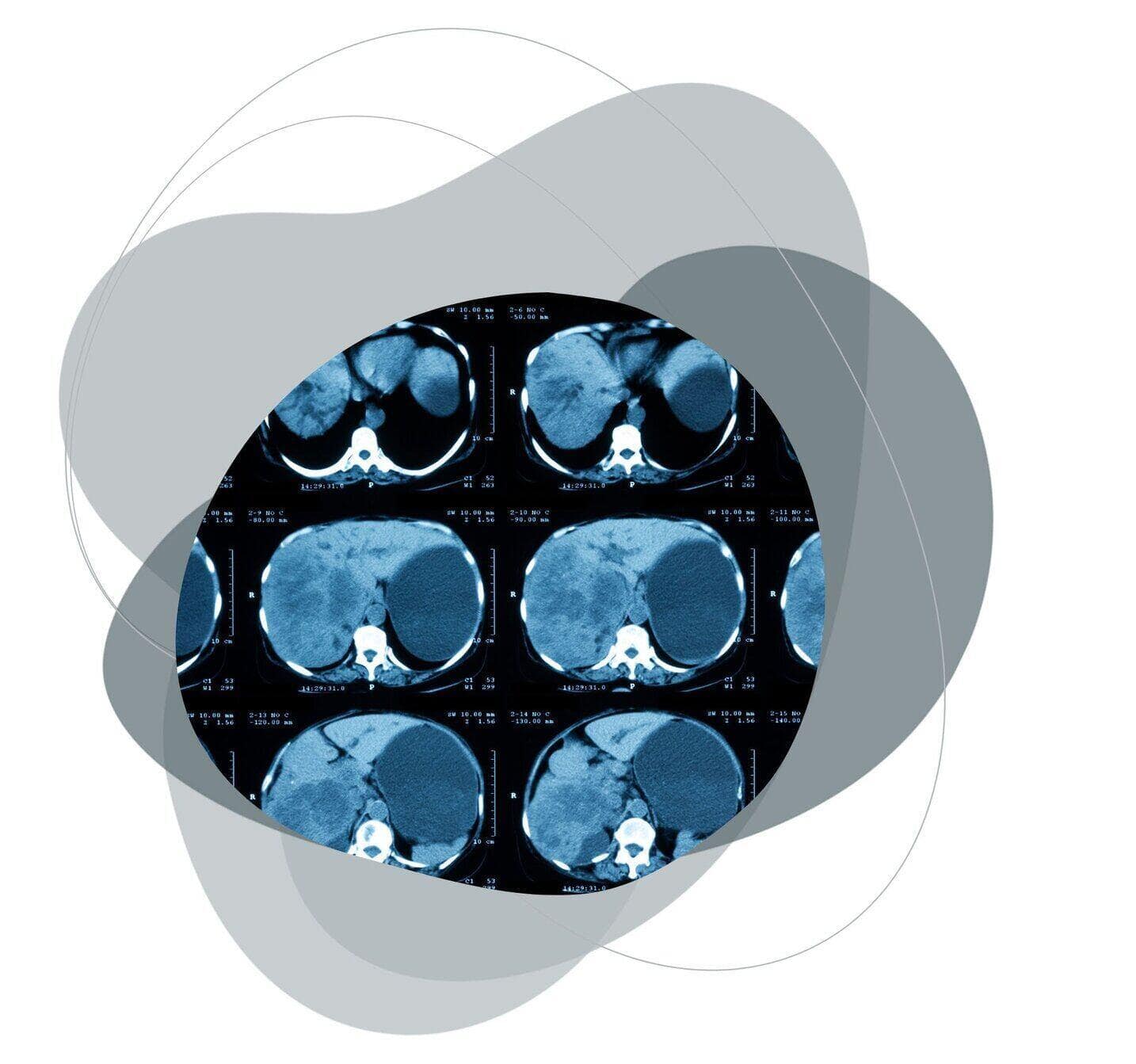 CASE STUDIES - Graylight Imaging