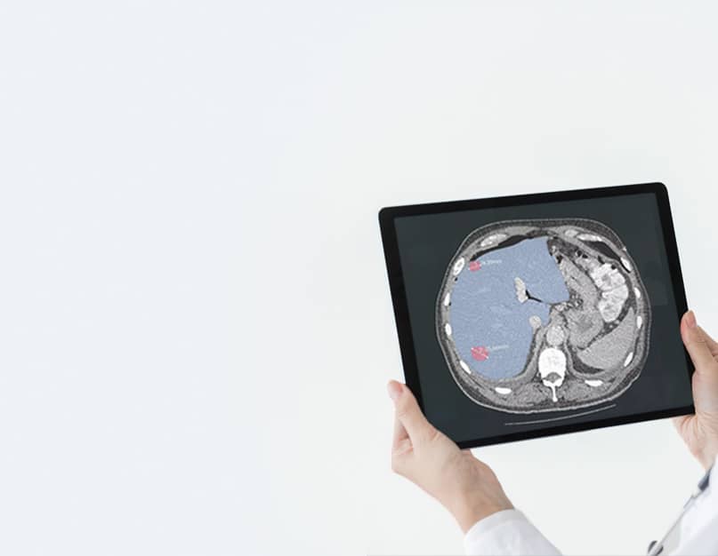 Liver And Liver Tumor Segmentation And Analysis